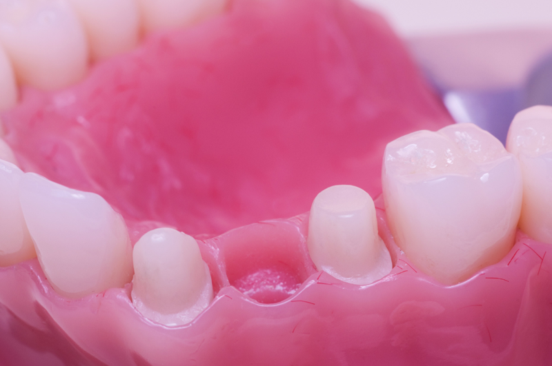 What Does A Prosthodontist Do?