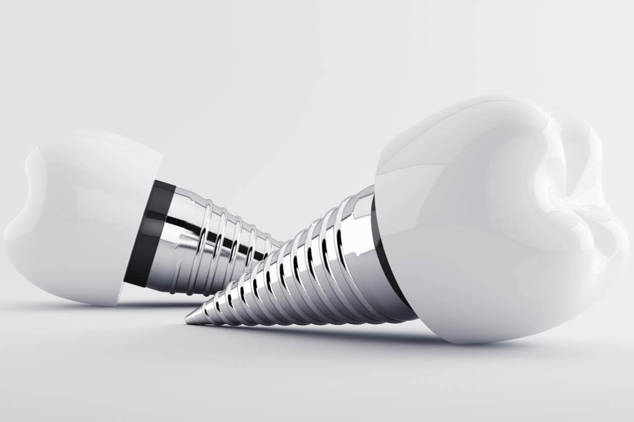 Stem cell dental implants: Are they possible? - eTransPlus